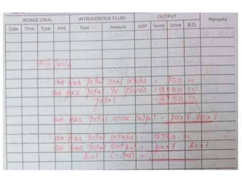 Urine Input Output Chart Ponasa