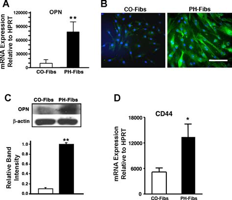 Pulmonary Adventitial Fibroblasts Isolated From Severely Hypertensive