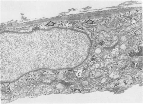Electon Micrograph Of Cultured Cells 10 14 Days Confirms Their