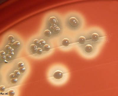 Medical Laboratory And Biomedical Science New Insights Into Group A Streptococcus