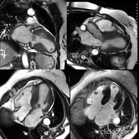 John Kozman Posted On Linkedin