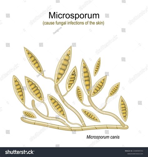 Microsporum Under Microscope Microscopic Fungi That Stock Vector