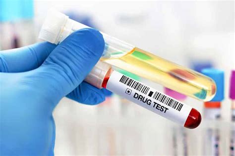 How Much Does A TB Test Cost 2025