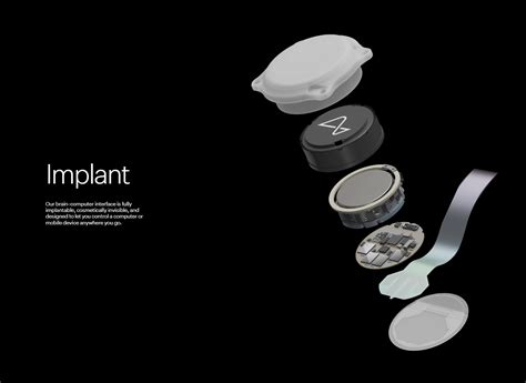 First Human Receives Neuralink Brain Implant Raising Hopes And Concerns