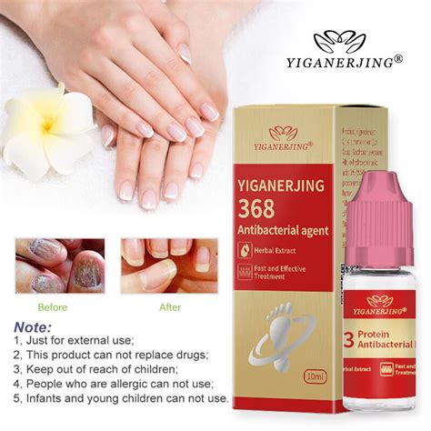 3pcs Yiganerjing Nail Fungal Treatment Essence Foot Nail Fungus Removal
