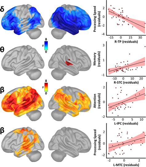 Spatio‐spectral Neural Oscillations Predict Cognitive Decline Along The