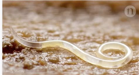 Parasitology Exam 4 Flashcards Quizlet