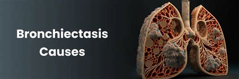 Causes Of Bronchiectasis Genetic Infections And Risk Factors
