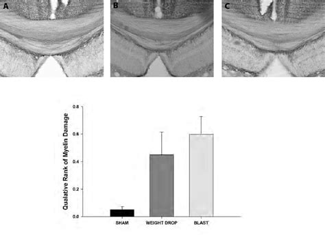Table 1 From Characterizing The Relationship Between Blast Exposure And Mild Tbi With Dynamic