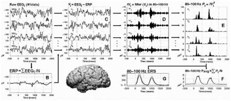 High Frequency EEG Activity Neupsy Key