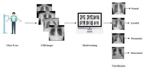 GitHub Lokesh Balamurugan Deep Learning Models For Diagnosing Pulmonary Lesions