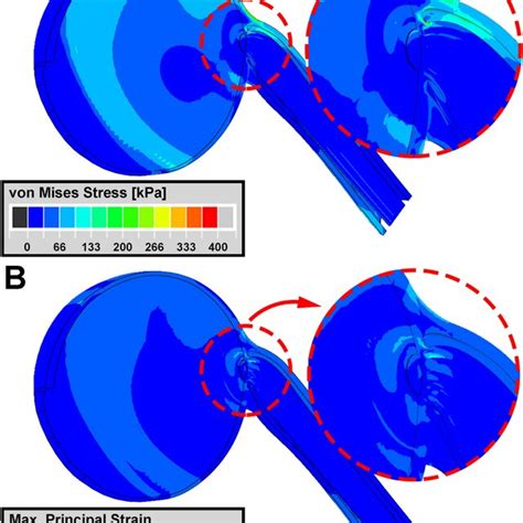 Simulation Of Adduction To 32° From Initial On Tethering At 26° Download Scientific Diagram