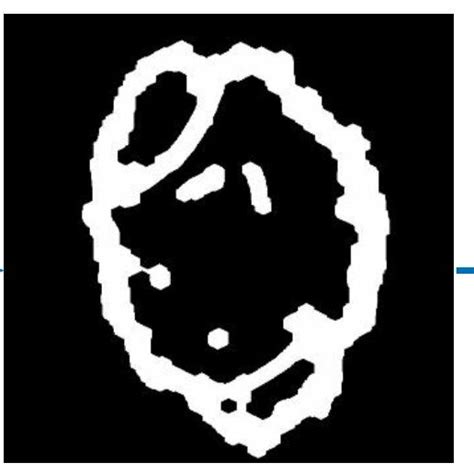 Segmented Skin Lesions Through Edge Detection Download Scientific