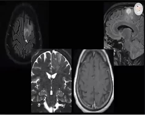 Renee Maiberger Msha R Eeg T Posted On Linkedin