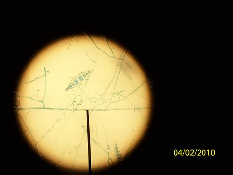Microbiology Techniques Sapprophyte