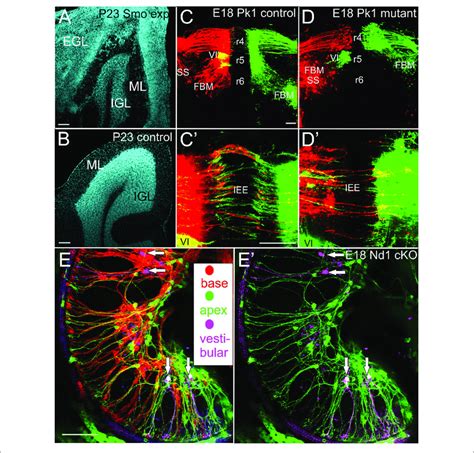 Pathological And Connectional Defects After Differential Migration