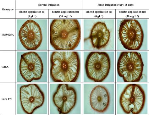 Pictorial Illustration Section Of Root Xylem Vessels Affected By