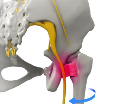 Muhammad Dughbaj On Linkedin Nice Capture Using Dynamic Sonography As An Extension To History And