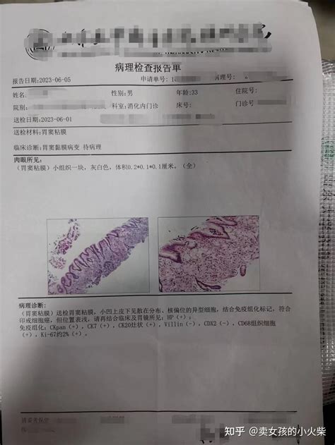 30几岁确诊胃印戒细胞癌何去何从 知乎