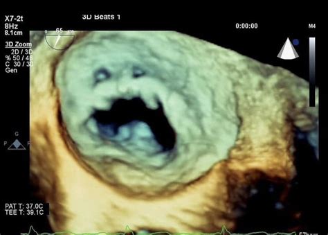 Farid Esmaeili On Linkedin Halloween