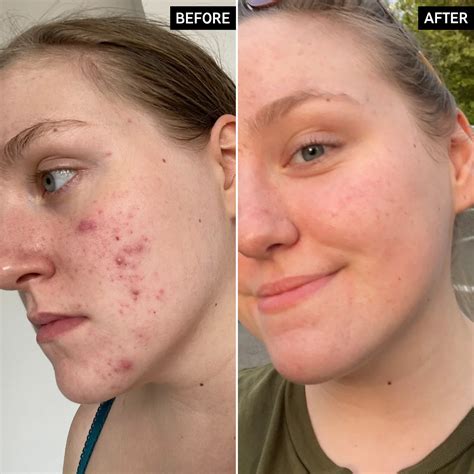 The Ordinary Glycolic Acid 7 Toning Solution Heygirlpk