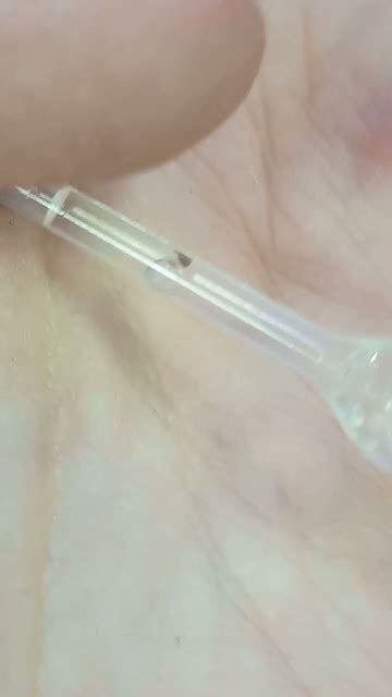 Xenacoelomorpha Youtube