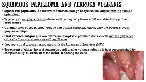 Solution Lektion Benign Tumors Of Oral Mucosa Studypool