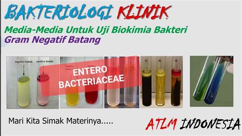 Media Uji Biokimia Bakteri Gram Negatif Batang Gula Imvic Tsia