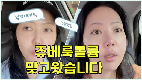 쥬베룩볼륨1탄 쥬베룩 볼륨 후기 눈밑꺼짐 광대꺼짐 팔자주름 급격히 나빠진 얼굴형에 맞고 왔어요 Youtube
