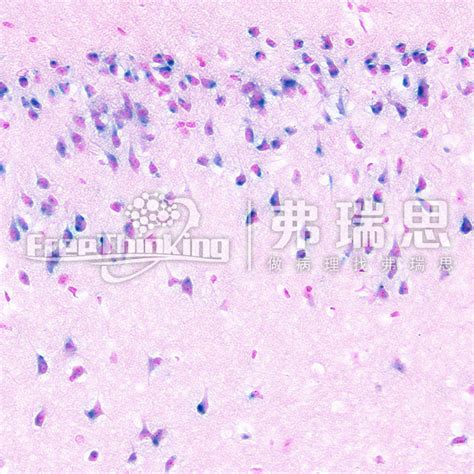 β 半乳糖苷酶染色 南京弗瑞思生物科技有限公司