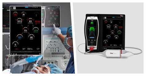 Masimo Gets Ce Mark For Lidco For Hemodynamic Monitoring