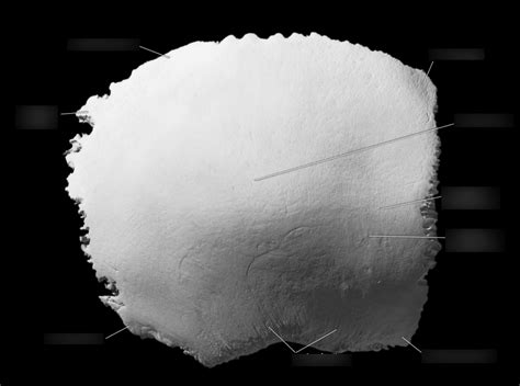 Parietal —ectocranial Diagram Quizlet