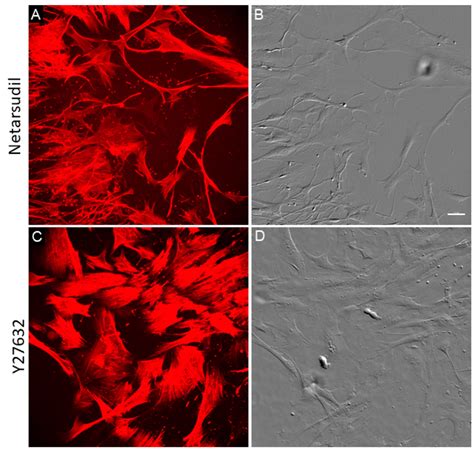 Prolonged Effects Of Netarsudil On Glaucomatous Tm Cells Gtm Cells Download Scientific Diagram