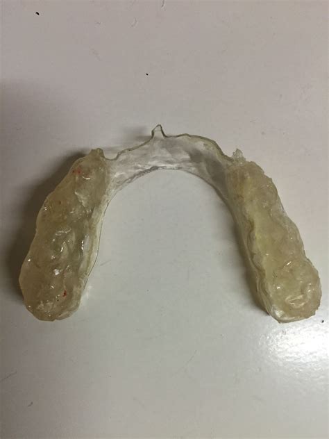 Tmj Splint Not Working At Andres Lowe Blog