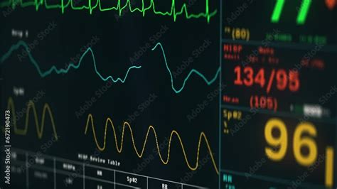 Pulse Test Monitoring Device Displays Stable Life Signs Of Patient Pulse Test Monitoring Device Displays Stable Life Signs Of Patient