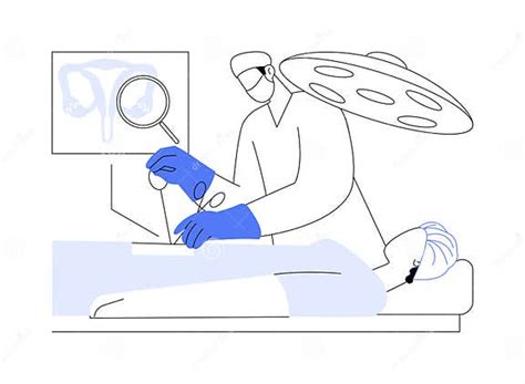 Female Pelvic Laparoscopy Abstract Concept Vector Illustration Stock