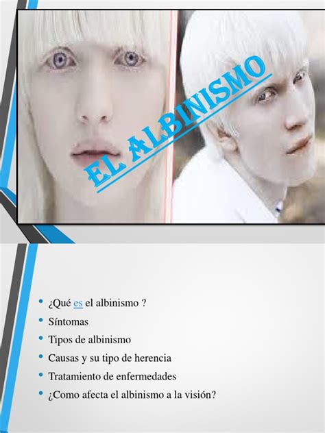 Causas Y Tipos De Albinismo Pdf Color De Los Ojos Enfermedades Y