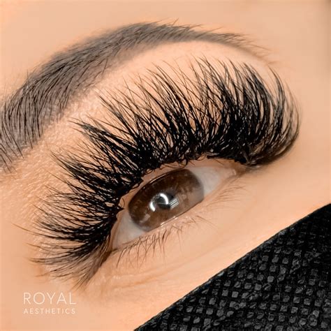 Services Royal Aesthetics