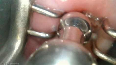 Cervix Pried Open And Penetrated Strangecares Clips4sale