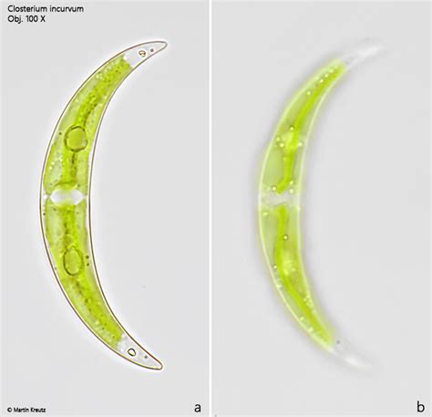 Closterium Incurvum Real Micro Life