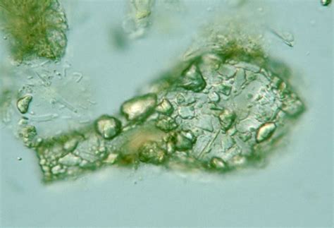 Protist Images Difflugia Oblonga
