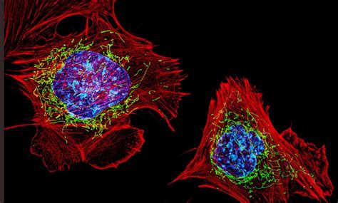 Sex Is A Costly Molecular Kind Of Wizardry Why Evolve It Aeon Ideas