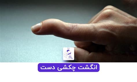 انگشت چکشی دست انگشت بیس بال انگشت مالت دکتر حسین اتحادی