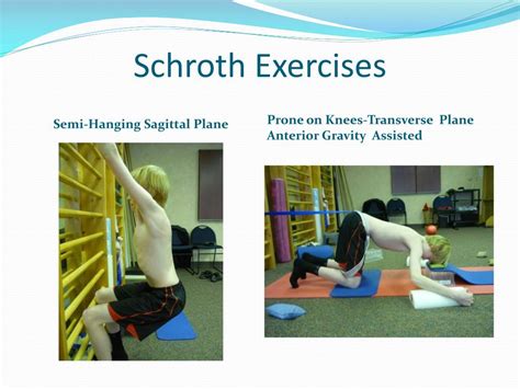 Ppt Schroth Method Powerpoint Presentation Free Download Id3286349