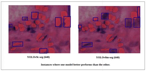 Yolov9 Instance Segmentation On Medical Dataset