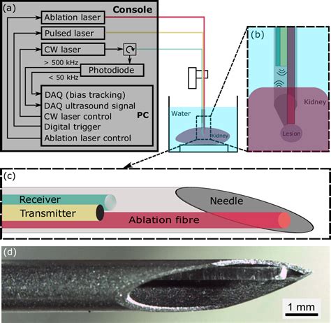 Figure 1 From Miniaturised Dual Modality All Optical Ultrasound Probe For Laser Interstitial