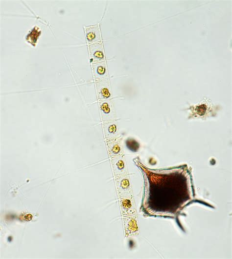 Protoperidinium Archivos Fitopasión