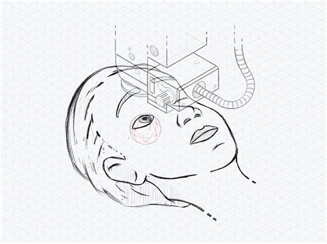 Eye Surgery Web Json Isometric Animation On Behance