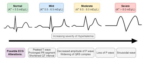Diseases Free Full Text Hyperkalemia In Diabetes Mellitus Setting