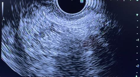 Radial Eus With Arrow Pointing To Ias Radial Eus With Arrow Pointing Download Scientific